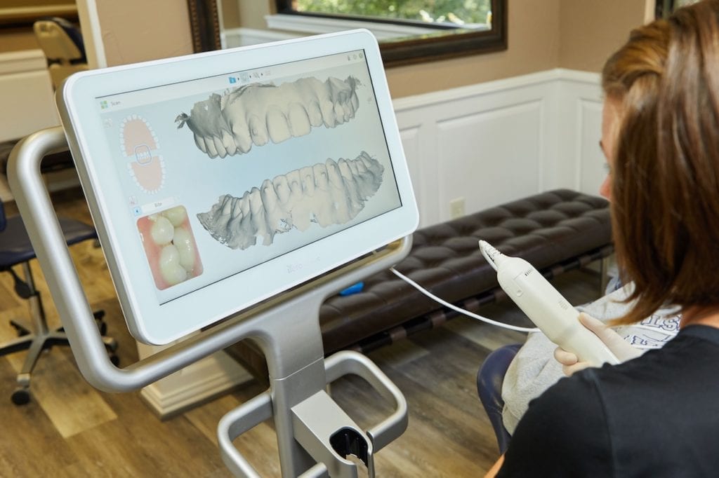 Invisalign Process Flower Mound TX | Clear Aligners Lewisville