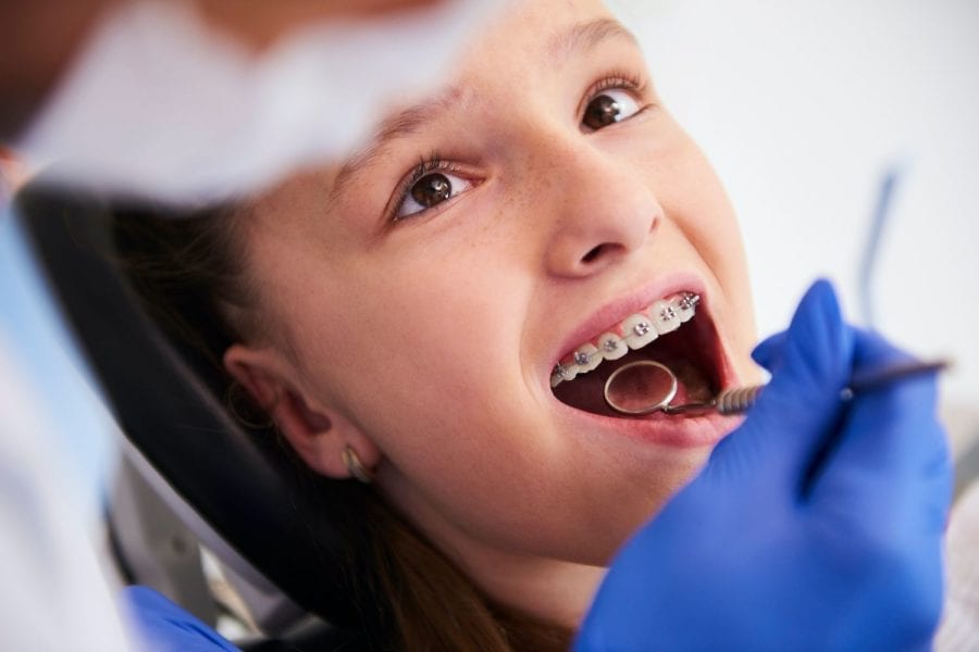 The Types of Braces | Flower Mound, TX Orthodontist