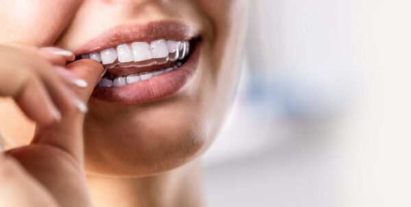 Compliance Tips for Invisalign - Flower Mound, TX Orthodontist